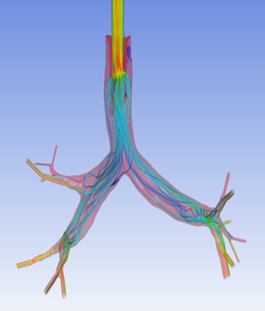 In Silico Testing for Medical Devices | StarFish Medical