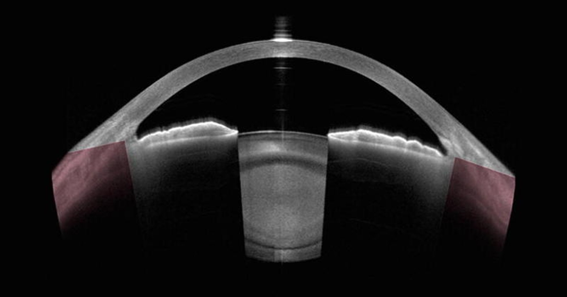 A Comparison of Detection and Imaging Methods Used in Optical ...