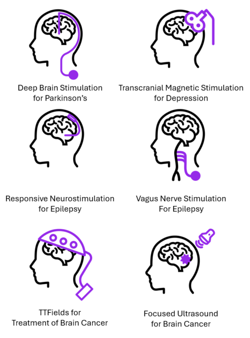 Drug-Device Combination Therapies for Parkinson’s Disease, | StarFish ...