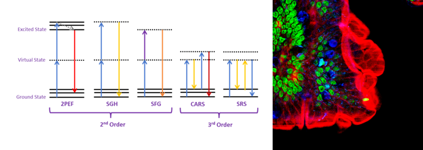 Revolutionizing Medical Imaging Devices with Optical | StarFish Medical