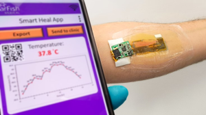 Smart Bandages for Wound Care | StarFish Medical