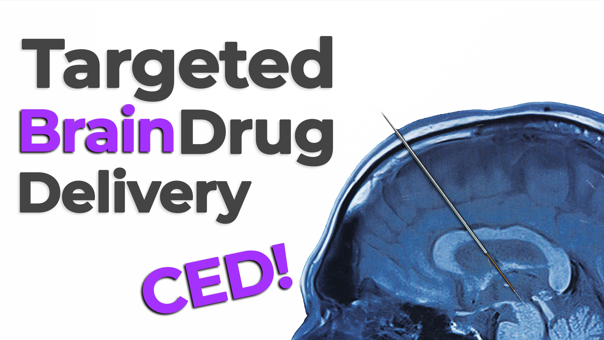 Convection-Enhanced Delivery: Infusing Precision into | StarFish Medical