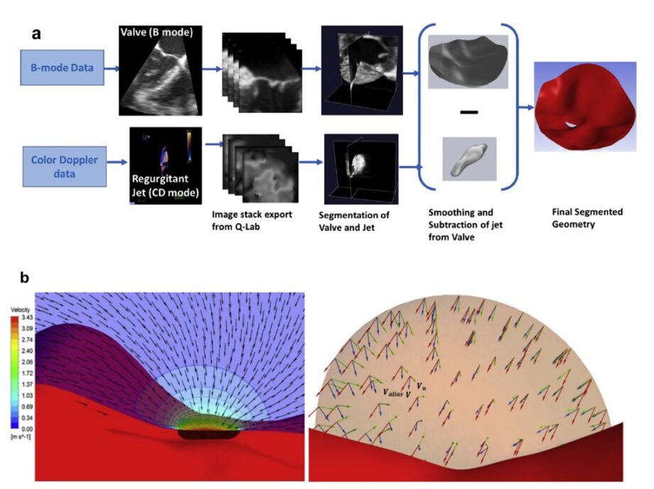 Heart valve simulation shifts the treatment | StarFish Medical