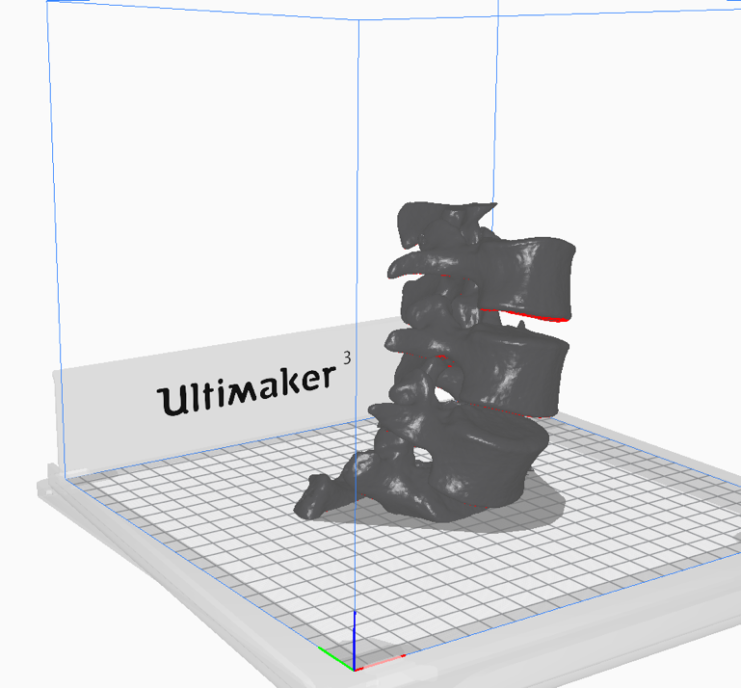 Patient Imaging Data 3D Models in Medical Design - StarFish Medical