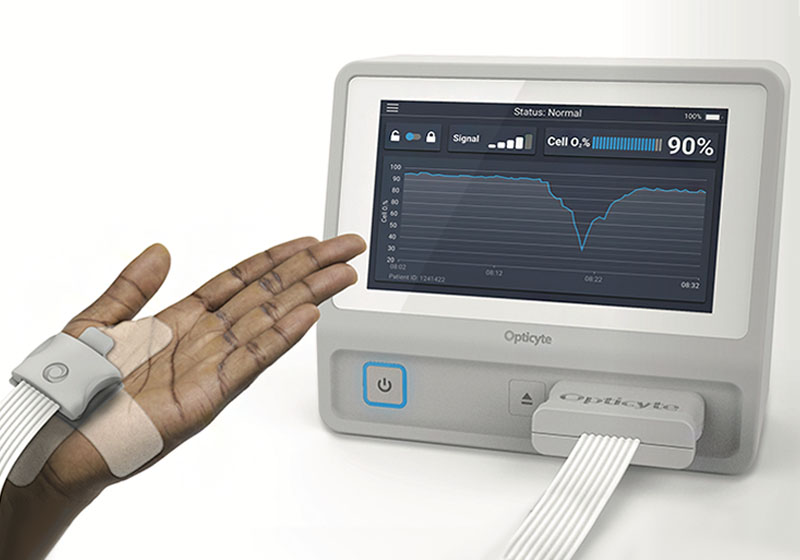 Opticyte Cell O2 Monitor | StarFish Medical